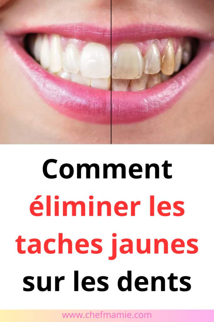 Comment éliminer les taches jaunes sur les dents - Chef Mamie