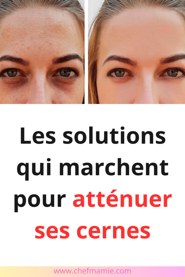 Les solutions qui marchent pour atténuer ses cernes - Chef Mamie